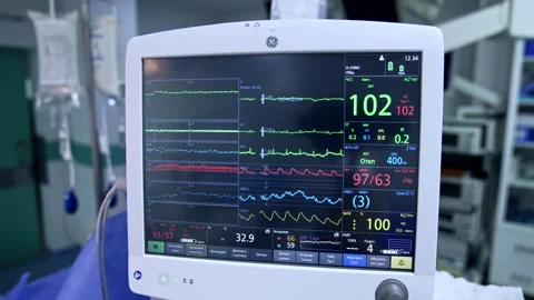 Monitor of artificial lung ventilation m... | Stock Video | Pond5