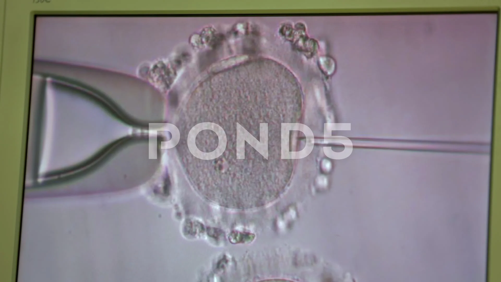 Human Female Egg Microscope