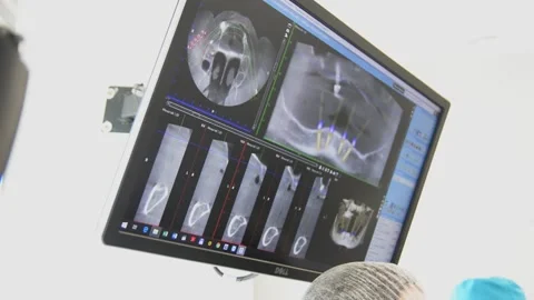 Monitor in the operating room with x-ray... | Stock Video | Pond5