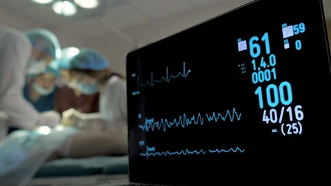 Patient Ecg Stock Footage ~ Royalty Free Stock Videos | Pond5