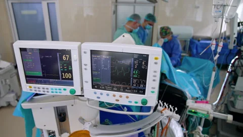 Monitors of lung ventilator machine show... | Stock Video | Pond5