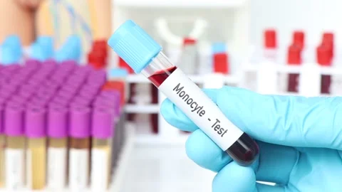 Monocyte test, blood sample to analyze i... | Stock Video | Pond5