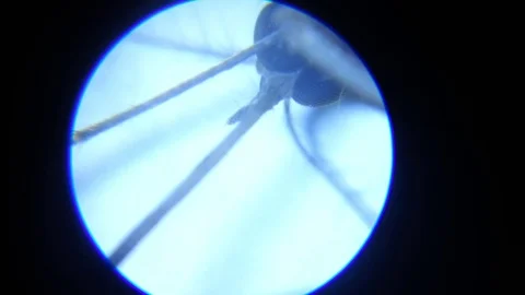 Mosquito Proboscis Through a Microscope | Stock Video | Pond5
