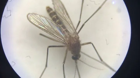 Mosquito seen through a microscope in Gu... | Stock Video | Pond5