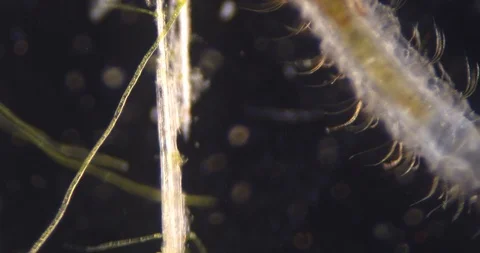 Moth fly larva, Clogmia, carrying air bu... | Stock Video | Pond5