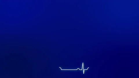 Motion Graphic of Normal EKG Waveform on... | Stock Video | Pond5