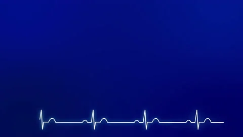 Motion Graphic of Normal EKG Waveform on... | Stock Video | Pond5