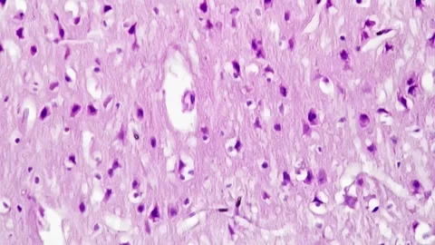 Motor cortex section of human being magn... | Stock Video | Pond5