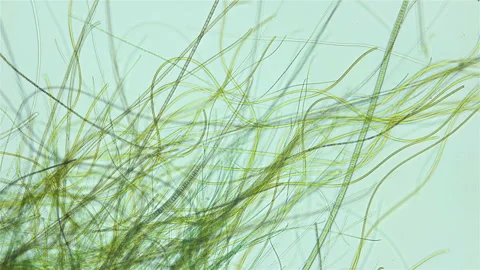 Movement of Cyanobacteria and Chlorobia ... | Stock Video | Pond5