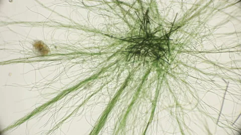 movement of live algae under a microscop... | Stock Video | Pond5