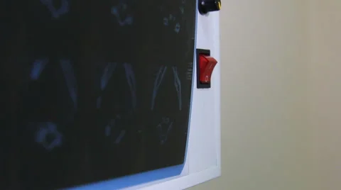 MRI and CT scanns on desk | Stock Video | Pond5