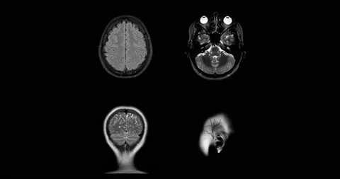 MRI of the brain in different projection... | Stock Video | Pond5