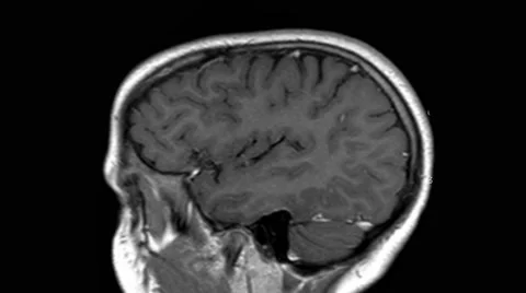 Sides Of Brain Stock Footage ~ Royalty Free Stock Videos | Pond5