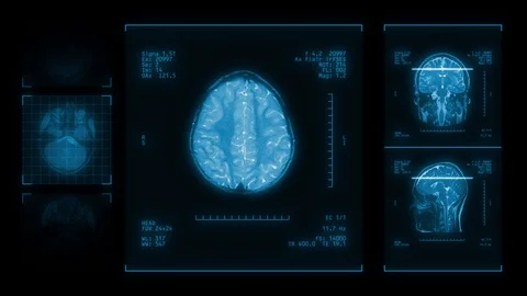 MRI brain scan in 4k | Stock Video | Pond5