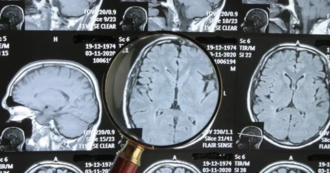 Mri brain scan background, magnetic reso... | Stock Video | Pond5