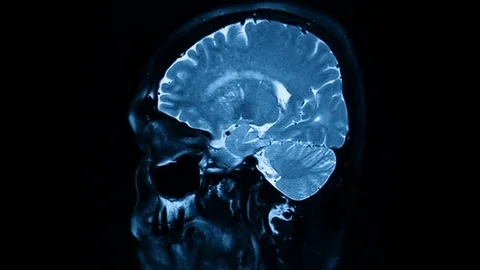 MRI brain scan on black background | Stock Video | Pond5