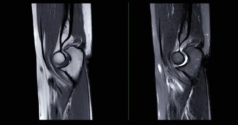 MRI elbow joint . | Stock Video | Pond5