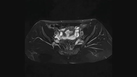 MRI of the female pelvic organs, abdomin... | Stock Video | Pond5