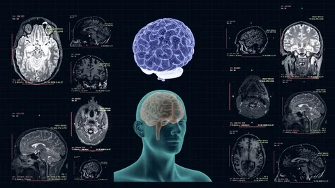 MRI of the human brain in different proj... | Stock Video | Pond5