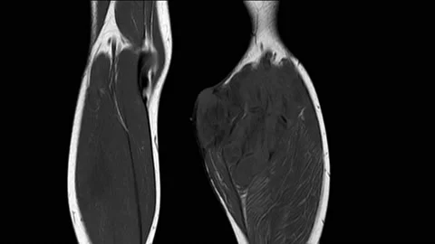 MRI (Magnetic resonance imaging) of Leg.... | Stock Video | Pond5