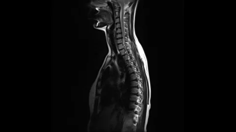 mri scan body side of a young female upp... | Stock Video | Pond5