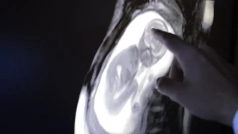 mri scan of a fetus on the mother belly.... | Stock Video | Pond5