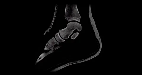 MRI scan of a foot showing multiple smal... | Stock Video | Pond5
