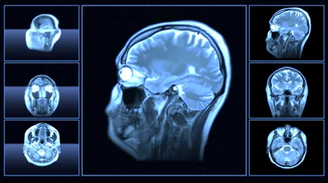 MRI scan | Stock Video | Pond5