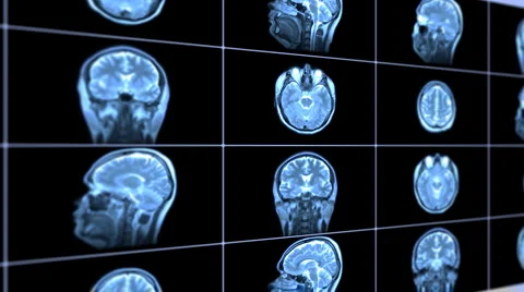 MRI scan | Stock Video | Pond5