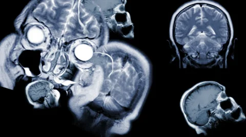MRI scan. Human brain. Animated backgrou... | Stock Video | Pond5