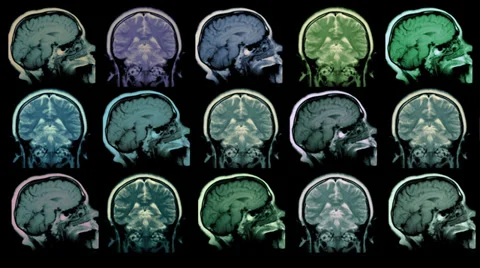 MRI scan. Human brain. Animated backgro... | Stock Video | Pond5