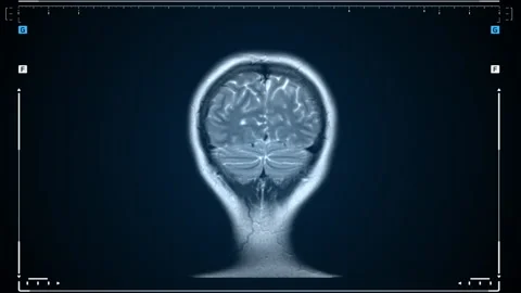MRI scan of a human brain in motion. Sca... | Stock Video | Pond5