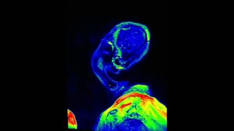 Mri Scan. Human Brain. RMN Scan. | Stock Video | Pond5