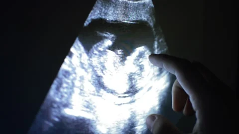 MRI scan pregnancy fetus. doctor with x-... | Stock Video | Pond5