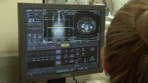 MRI scan screen animation. Computed medi... | Stock Video | Pond5