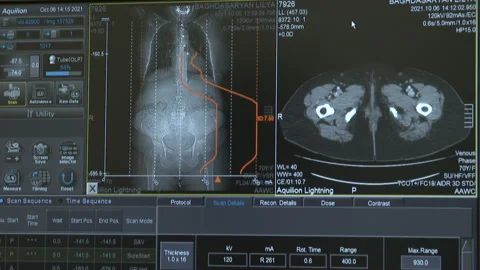 MRI scan screen animation. Computed medi... | Stock Video | Pond5