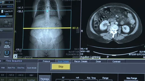 MRI scan screen animation. Computed medi... | Stock Video | Pond5