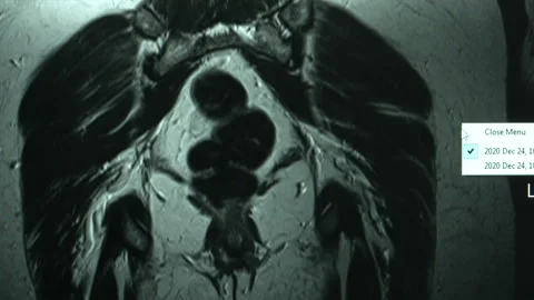 MRI scan screen animation. Computed medi... | Stock Video | Pond5