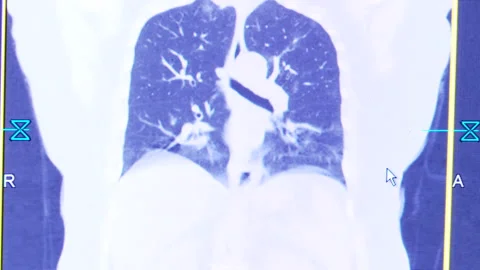 MRI scan screen animation. Computed medi... | Stock Video | Pond5