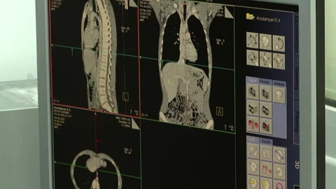 MRI scan screen animation. Computed medi... | Stock Video | Pond5