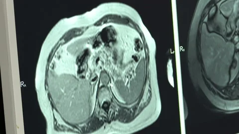 MRI scan screen animation. Computed medi... | Stock Video | Pond5