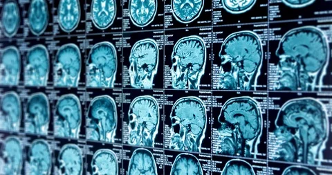 MRI scans in eight rows scroll up, loope... | Stock Video | Pond5