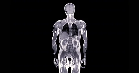 MRI whole body scan. | Stock Video | Pond5