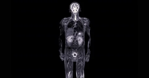 Mri Body Scan Stock Video Footage | Royalty Free Mri Body Scan Videos ...