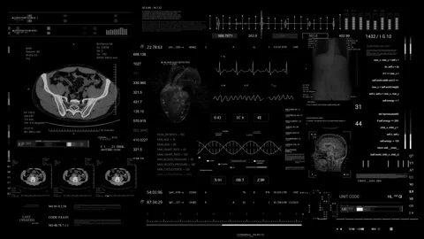 MRI x ray CT Scan.Medical HUD Analyzing ... | Stock Video | Pond5