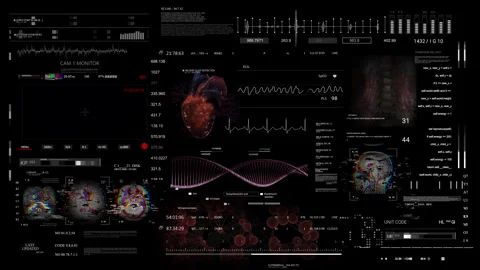 MRI x ray Scan, micro surgery arthroscop... | Stock Video | Pond5