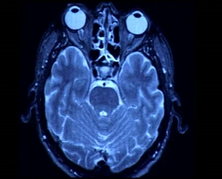 MRT scan slices | Stock Video | Pond5