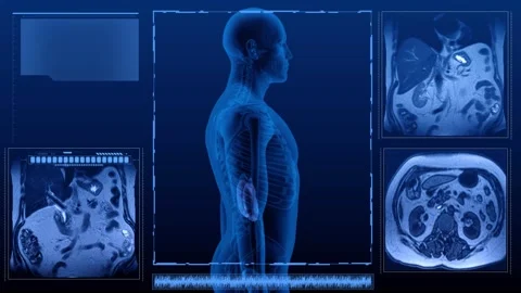 multi MRI human urinary system kidneys | Stock Video | Pond5