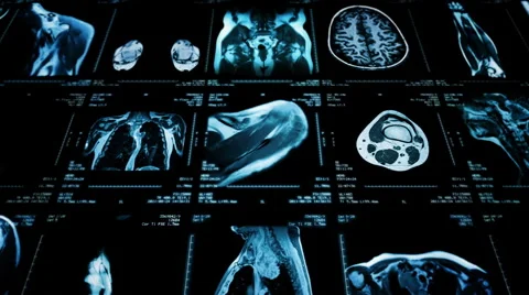 Video Shite Stock Videos – Royalty-Free HD & 4K Videos | Pond5