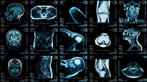 Multiple MRI video wall. Black and white... | Stock Video | Pond5